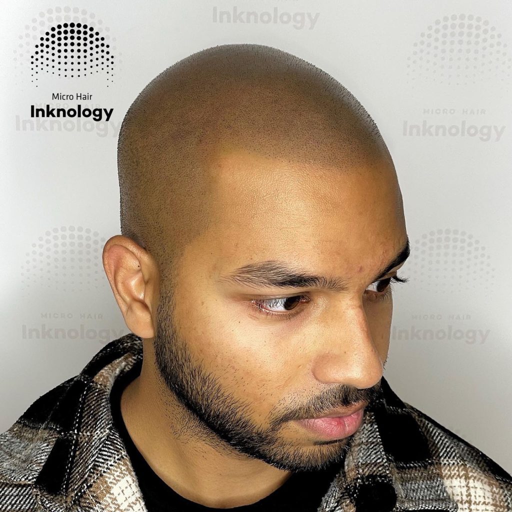 Haar Tattoo in Nederland | Micro Haar Pigmentatie | Inknology