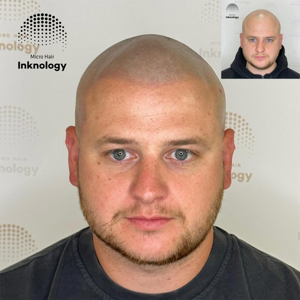 Resultaten - Inknology